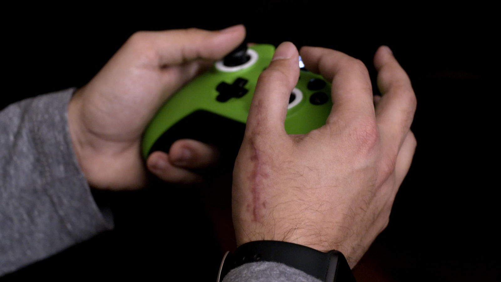 Regaining Control: "SC Featured" Profiles esports Star's Recovery From ...